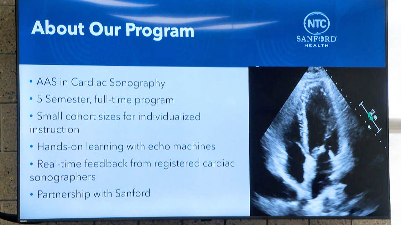 Northwest Technical College in Bemidji To Start Cardiac Sonography Program